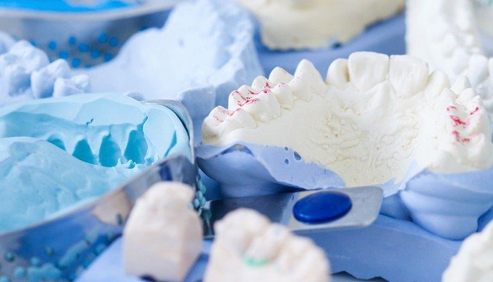 Obligation de transmettre les moulages odontologiques aux patients qui ...